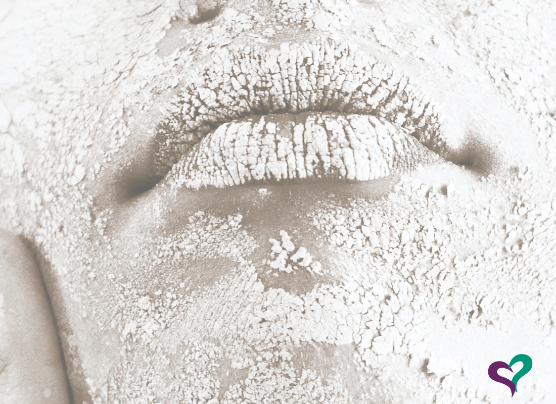 ¿Por qué tengo los labios secos y agrietados? | Conoce las causas